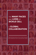 The Many Faces and Lives of Sickle Cell – A Global Collaboration ...
